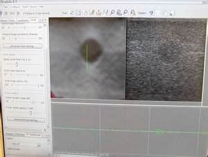 Naked Engineering Ultrasound Interviews