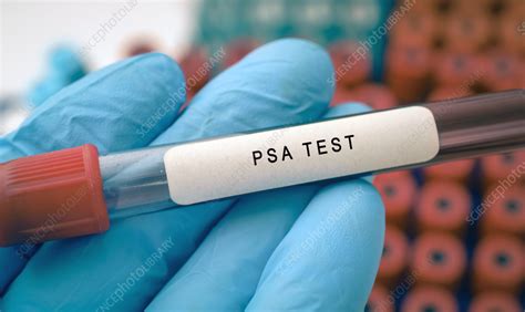 Prostate Specific Antigen Test Conceptual Image Stock Image F036 7508 Science Photo Library