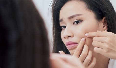 How To Get Rid Of Cheek Acne Proactiv