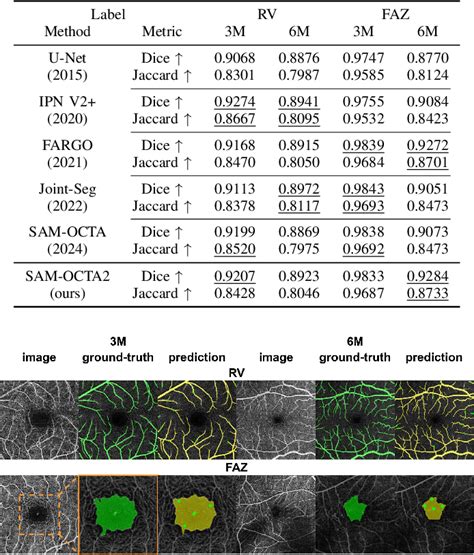 Sam Octa2 Layer Sequence Octa Segmentation With Fine Tuned Segment Anything Model 2