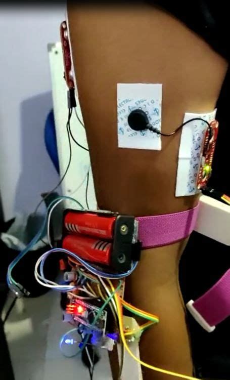 Emg Arduino Embeddedsystems Microcontrollers Machinelearning Ffnn