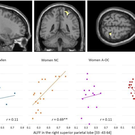 Relationship Between The Amplitude Of Low Frequency Fluctuations Alff Download Scientific