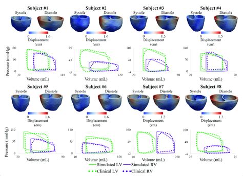 Displacement Maps Of Ventricular Models At End Systole And Download Scientific Diagram