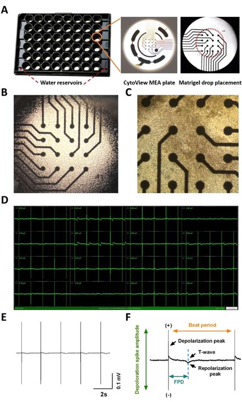 Technical Applications Of Microelectrode Array And Patch Clamp Recordings On Human Induced