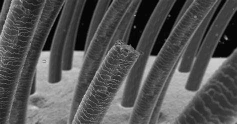 How To Prevent Hair Loss During Weight Loss Shed Weight Not Hair