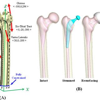 The Finite Element Models Used In This Study A The Model With Hip Download Scientific
