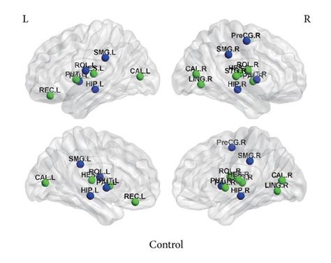 Hubs For Brain Functional Networks In Control A And Deaf B Groups Download Scientific