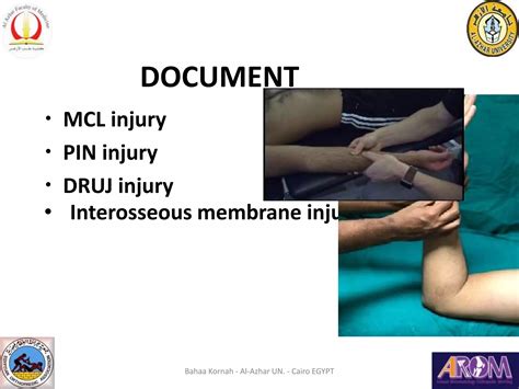 Radial Head Fracture Ppt