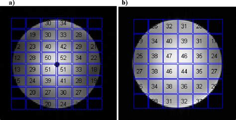 Figure From HIGH FREQUENCY TRANSMIT RECEIVE PHASED ARRAY COIL FOR HEAD AND NECK MR