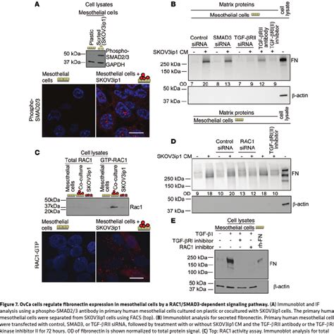 Tumor Cells Induce Fibronectin Expression In Mesothelial Cells Through