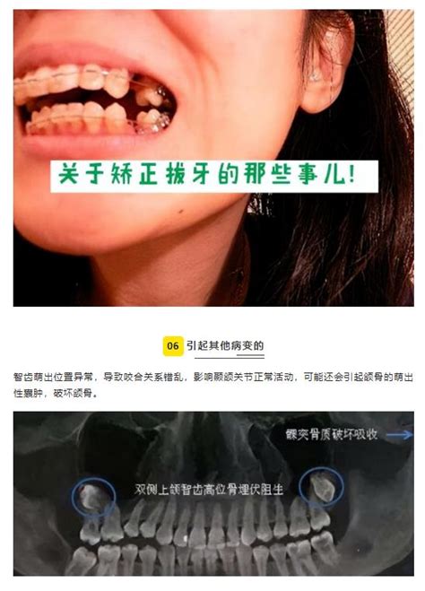 宝爸宝妈们注意了开学必读收下这份开学前口腔检查指南 医院动态 苏州口腔医院