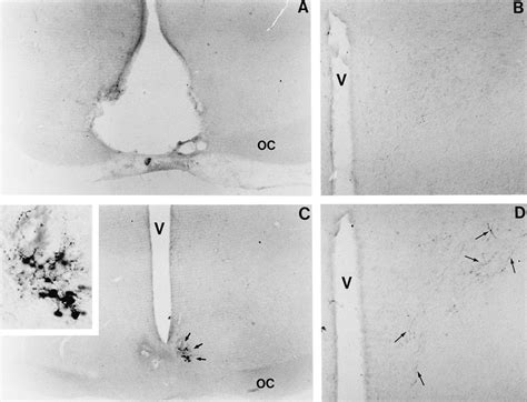 Photographs Of Coronal Brain Sections At The Level Of The Scn A C