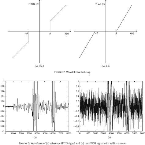 Figure 1 From Design Methodology Of A New Wavelet Basis Function For Fetal Phonocardiographic