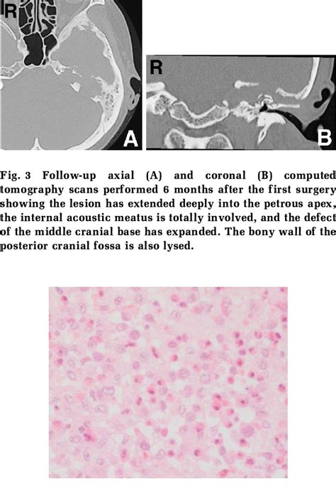 Photomicrograph Showing Diffuse Proliferation Of Histiocytic Cells Download Scientific Diagram