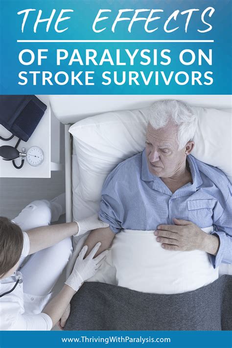 The Effects Of Paralysis After A Stroke