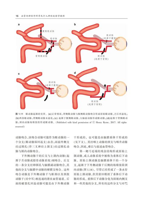 【好书推荐】《血管内神经外科学及介入神经放射学教程》 脑医汇 神外资讯 神介资讯
