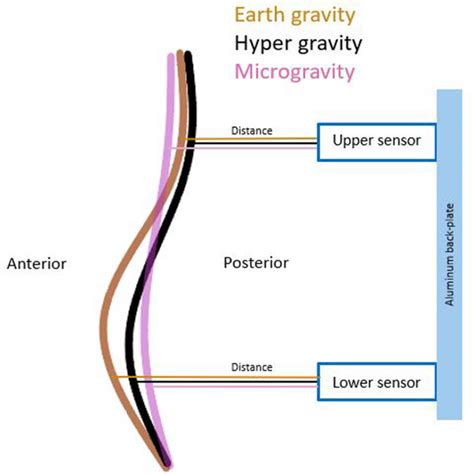 Microgravity And Hypergravity Induced By Parabolic Flight Differently