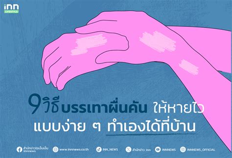 9 Ways To Relieve The Rash Quickly Easy To Do At Home Thailandtv News 9 Ways To Relieve The Rash Quickly Easy To Do At Home Thailandtv News