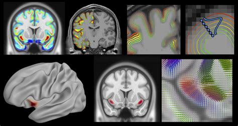 mapping frontoinsular cortex from diffusion microstructure ryan cabeen