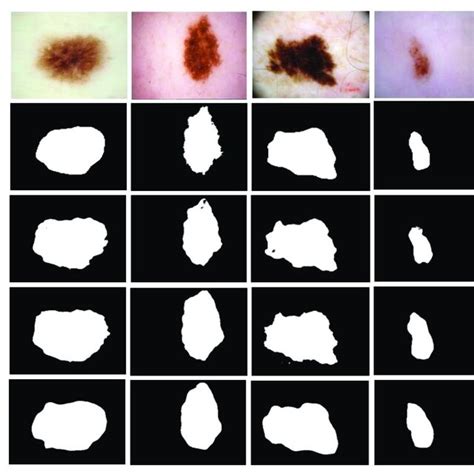 Isic 2018 Segmentation Output Sample Download Scientific Diagram