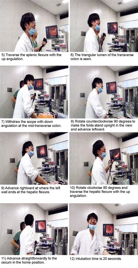 Water Immersion Colonoscopy Technique