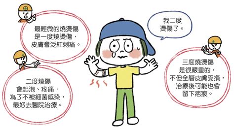 燙傷了怎麼辦 親子生活 KidsPlay親子就醬玩