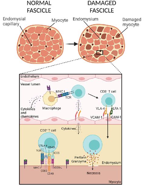 Pathophysiology Of Polymyositis Polymyositis Is Characterized By An Download Scientific