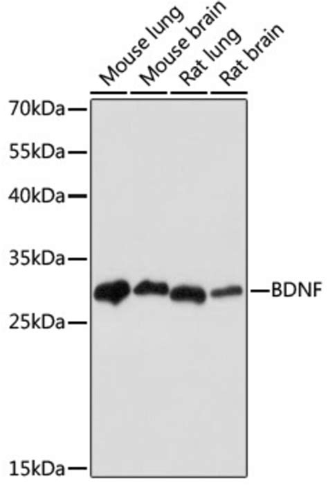 Bdnf Monoclonal Antibody Invitrogen 100 μl Unconjugatedantibodies