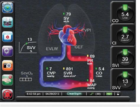 Ppt Cardiac Output And Hemodynamic Measurements Power