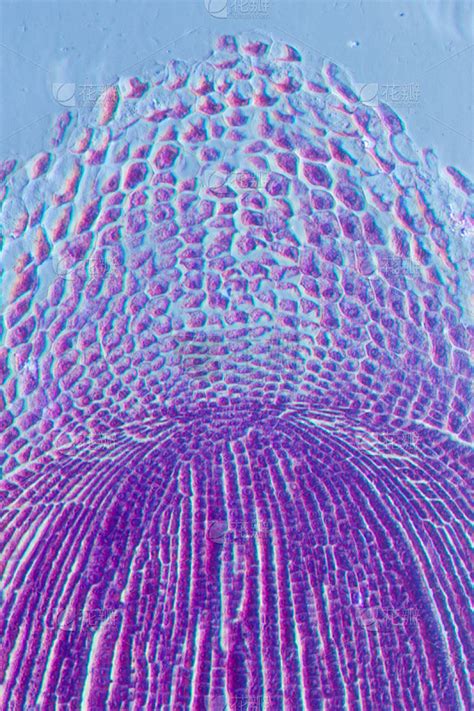 微生物学 植物 细胞 根尖 韧皮部 木质部 维管束 大规模的放大 显微图片 显微镜