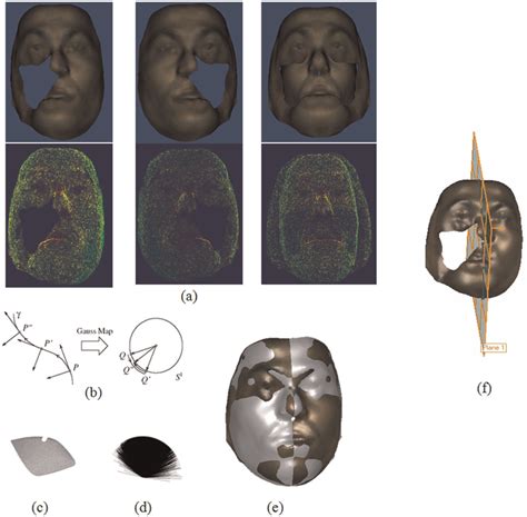 Illustration Of The Symmetry Operator A Rough Alignment Of Patients Download Scientific