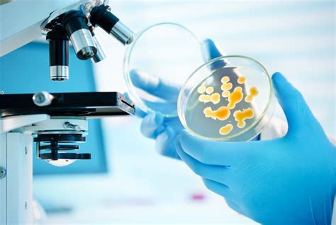 Aabb Conference On Secondary Bacterial Screening Of Platelets