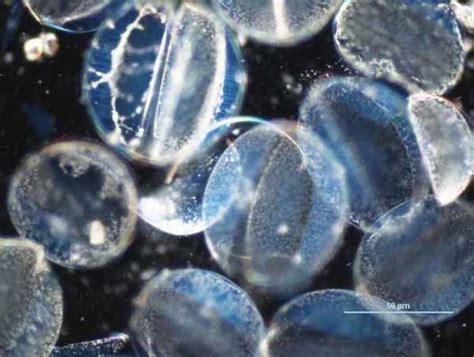 Bloom Of Hemidiscus Hardmannianus Bacillariophyceae And Its Impact On