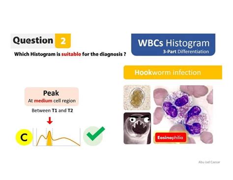 Wbc Histogram