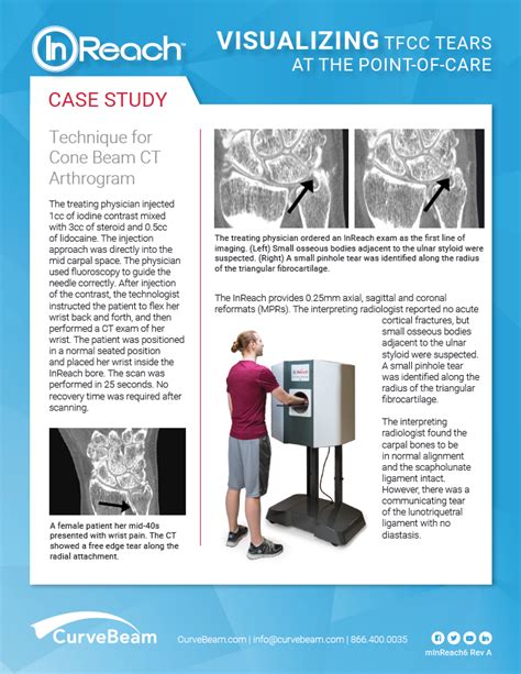 Tfcc Tear Diagnosis And Treatment Options Hand Center Of Louisiana