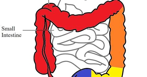 General Health Info Symptoms Of Colitis