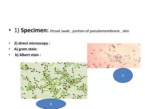 Corynebacterium Diptheriae Ppt