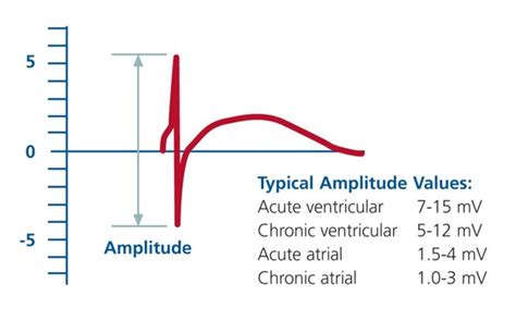 Sensitivity Testing And Programming Basic Electronics And Physics