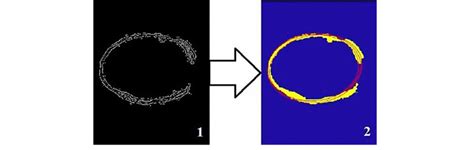 1 Canny Edge Detector Result 2 Hough Transform Result Download