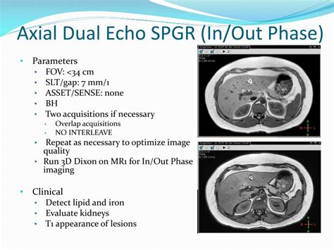 Ppt Liver Mri Powerpoint Presentation Free Download Id 1844365