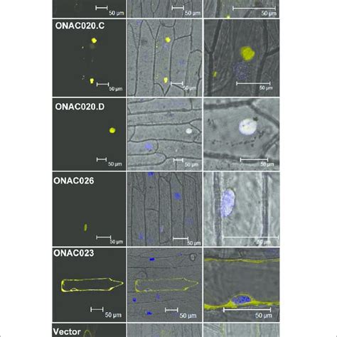 Subcellular Localization Of Nac Yfp Fusion Proteins A Represents
