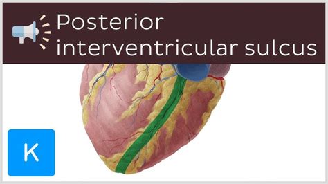Arteria Interventricular Posterior