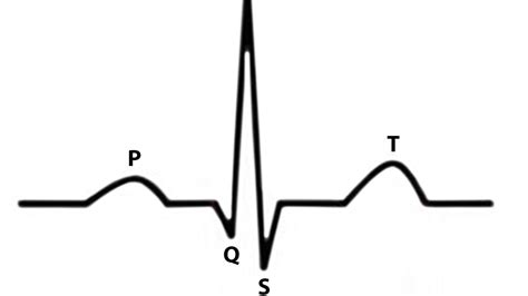 Dental Update Drug Induced Prolongation Of The Qt Interval Implications For Dental Prescribing