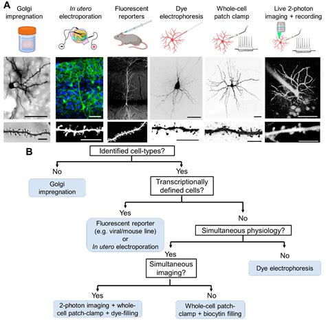 Dendritic Spine Types
