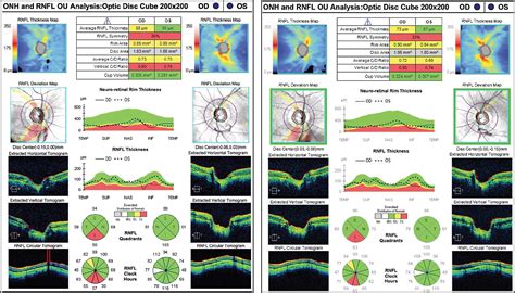 Ophthalmology Management Pentavision
