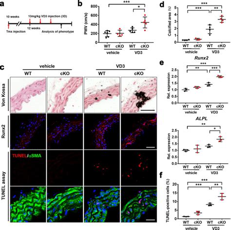 Cdon Suppresses Vascular Smooth Muscle Calcification Via Repression Of
