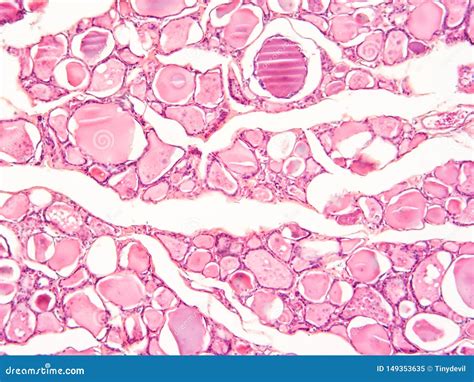 Histology Of Human Thyroid Gland Tissue Stock Image Image Of Thyroid Microscope 149353635