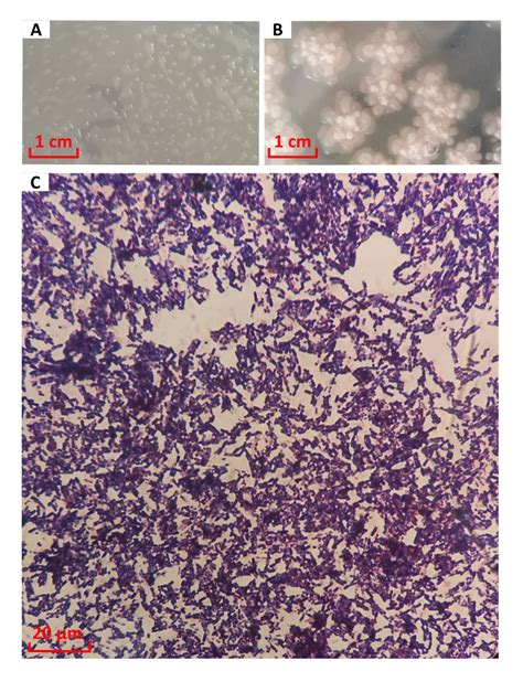 Video Isolation Purification And Identification Of Bacitracin Producing Bacillus