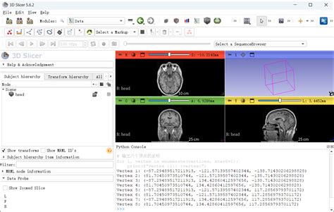 请问将三维模型导入slicer后，如何得到3d Cube中各个顶点的三维坐标？ 问题求助 3dslicer中文论坛