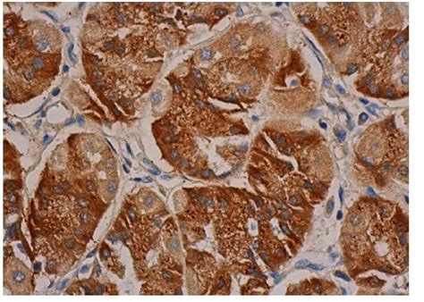 Anti Pdgf Receptor Betapdgfr β Antibody 18a2 Scbt Santa Cruz